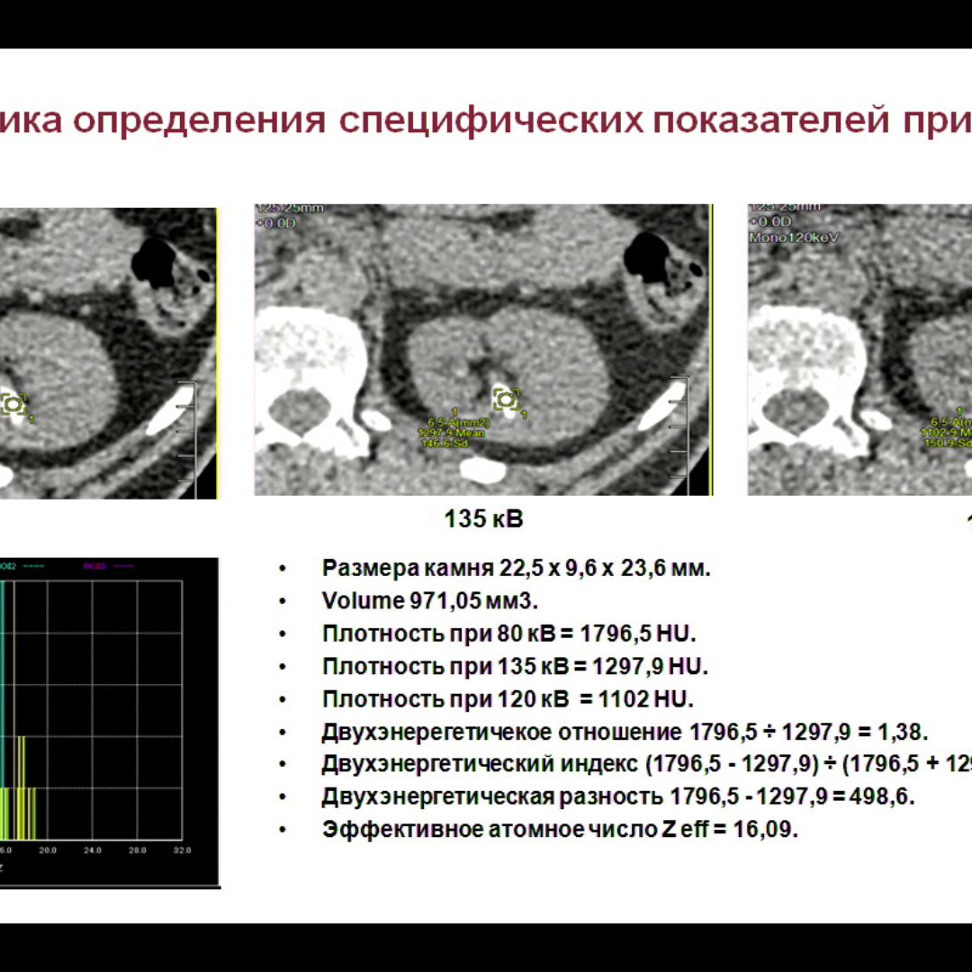 Капанадзе Л.Б. - Современные лучевые технологии в диагностике МКБ ...