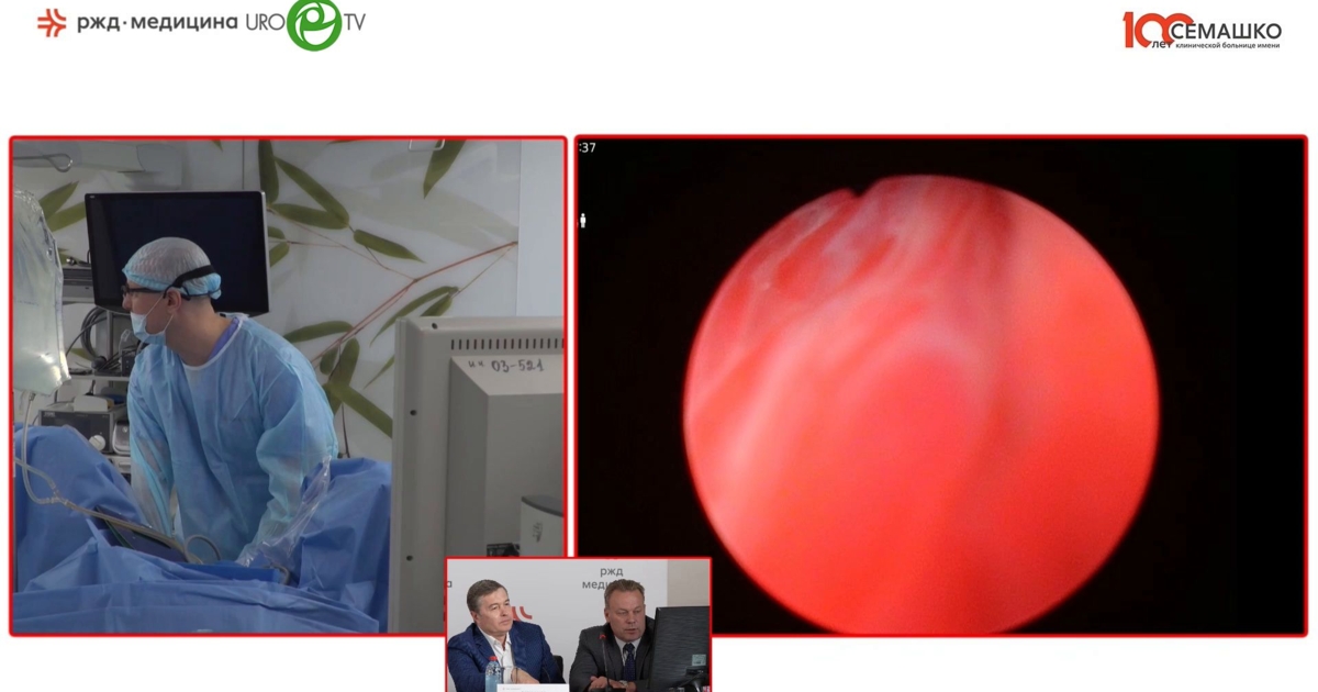 Бурлака О.О. - Гольмиевая высокоэнергетическая энуклеация простаты с ...